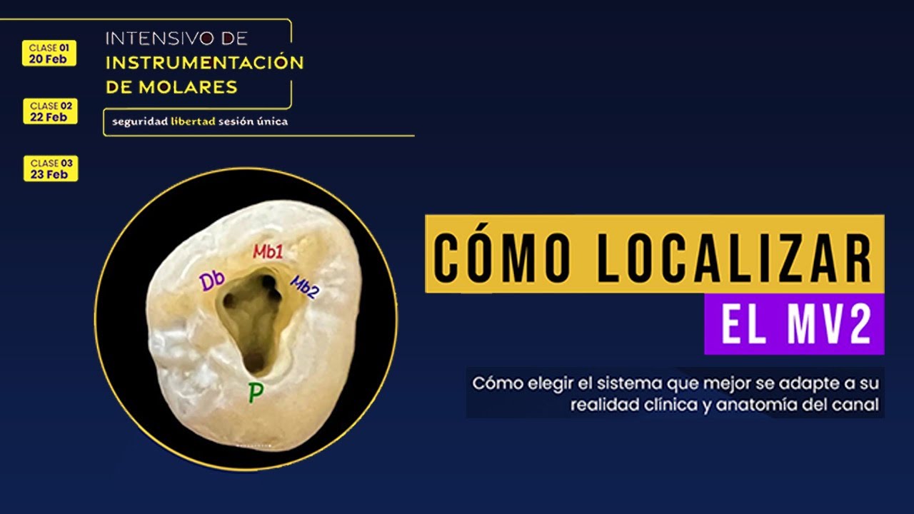 C mo Localizar El MV2 YouTube