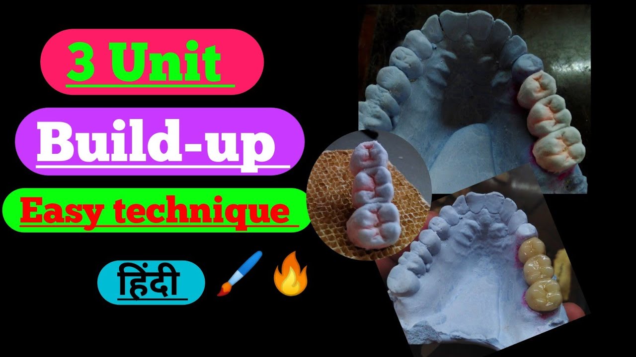 3 Unit Build up| Three Units Ceramic Porcelain| Anatomy| Porcelain| How ...