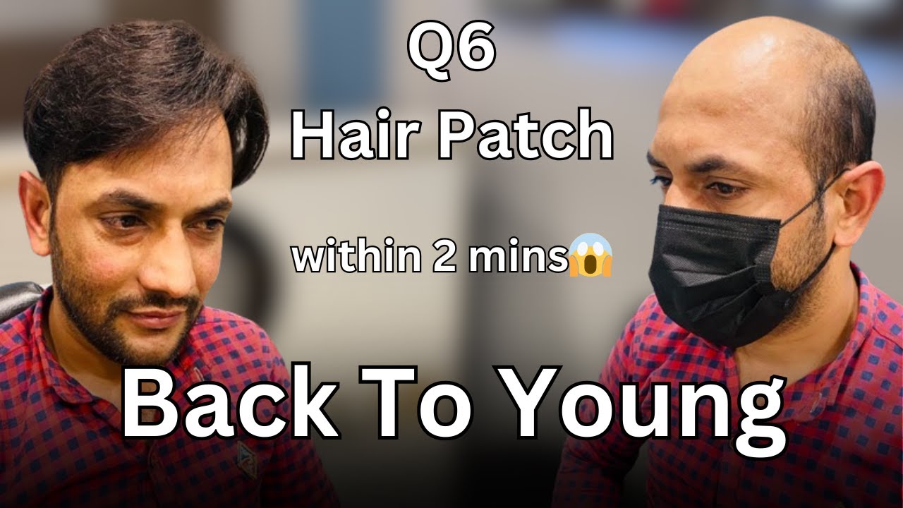 Back To Young Age | Q6 Natural Hair Patch | Hair Look Club - YouTube