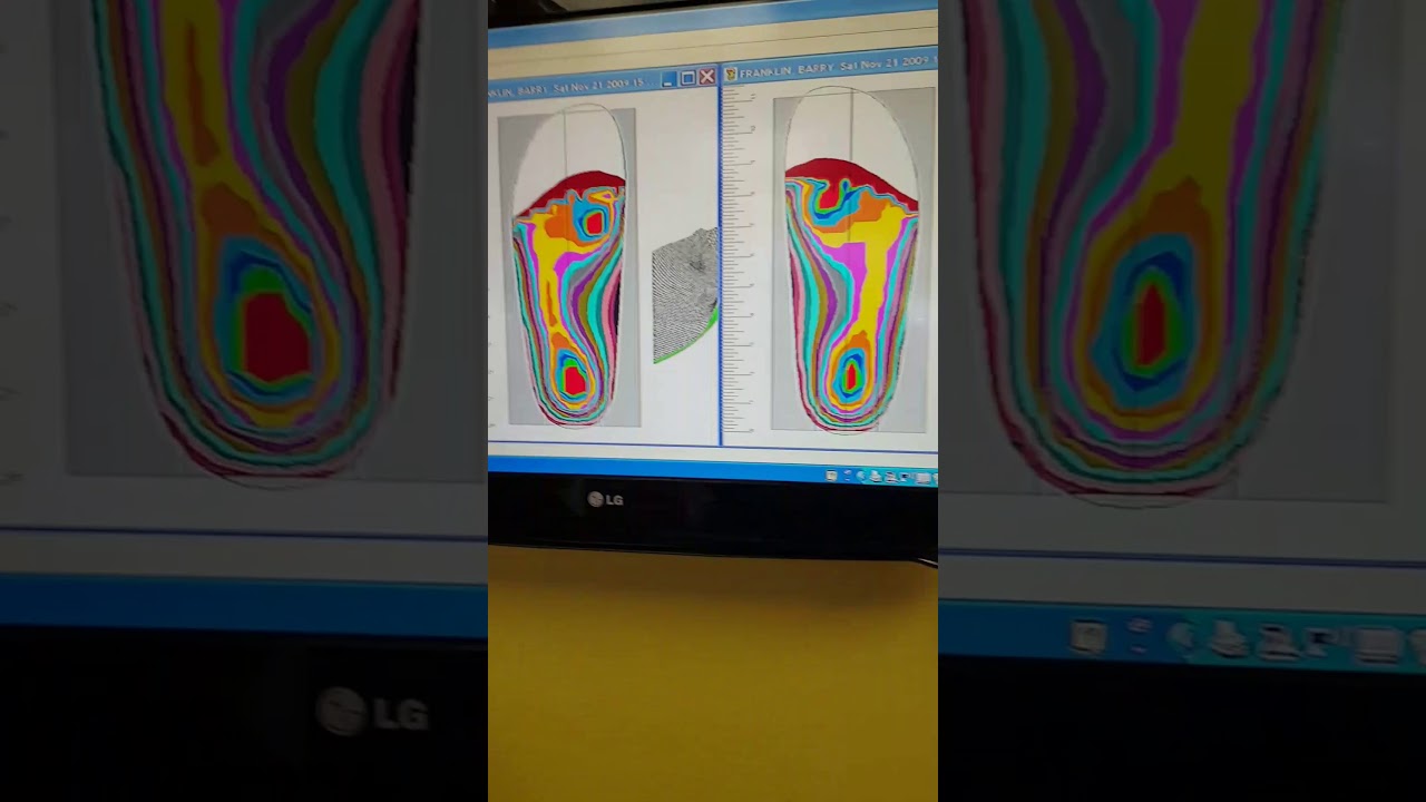 How To Read A Foot Scan YouTube how-to-read-a-foot-scan-youtube