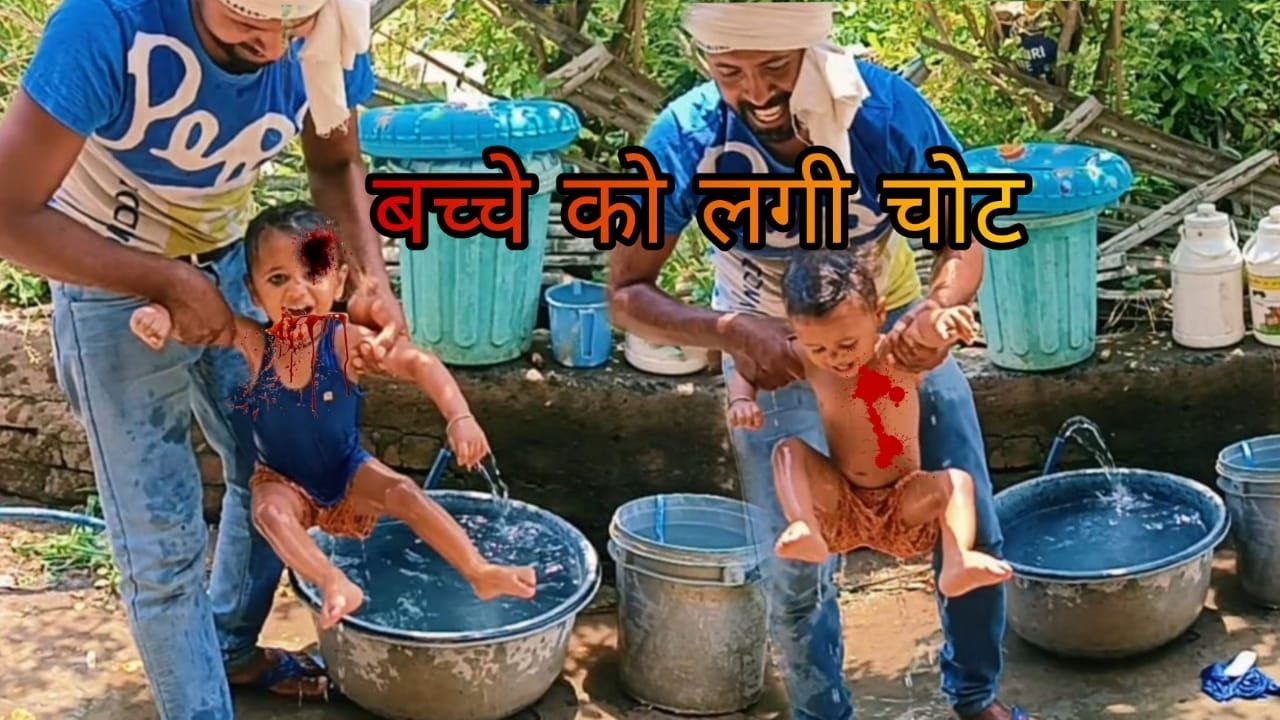 बेबी को लगी चोट (Baby Gets Hurt and gets a Boo Boo) Hindi Rhymes For ...