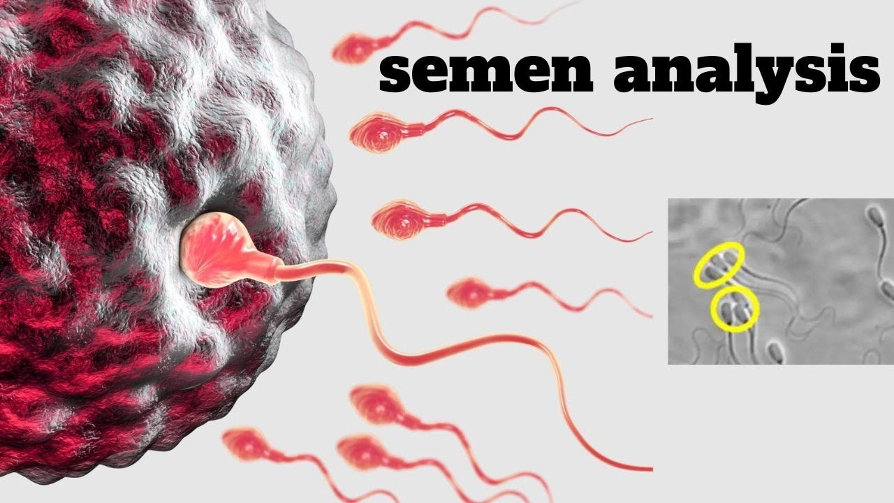 Semen Analysis Youtube