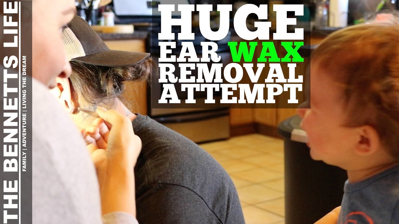 HUGE EAR WAX REMOVAL ATTEMPT | YEAR 2, DAY 133 - YouTube