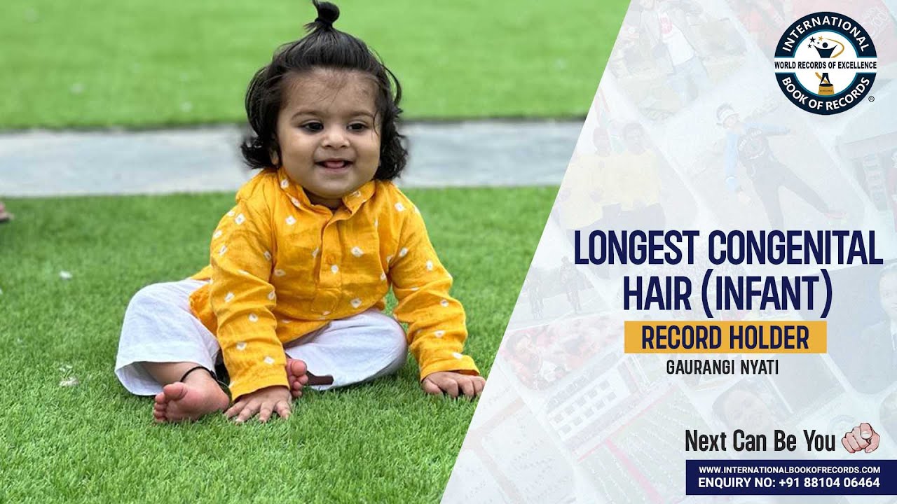 LONGEST CONGENITAL HAIR (INFANT) - YouTube