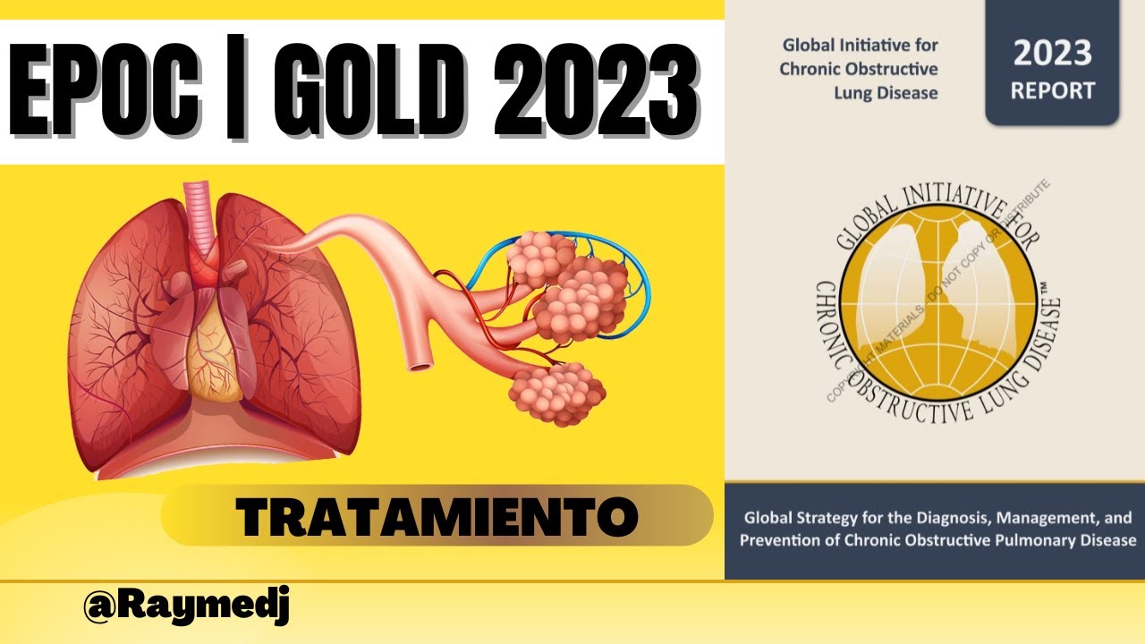 GOLD 2023: Tratamiento EPOC - YouTube