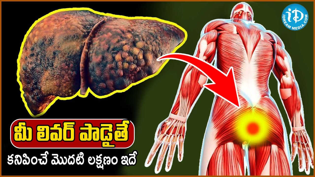 10 Symptoms of Liver Problem | Fatty Liver Symptoms | liver damage Sign ...