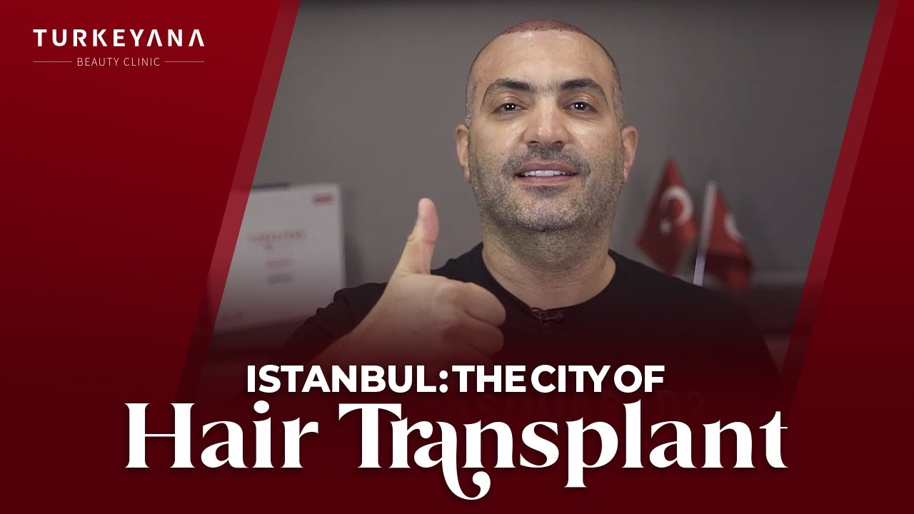 Getting a Hair Transplant at TURKEYANA CLINIC | From Venezuela to ...