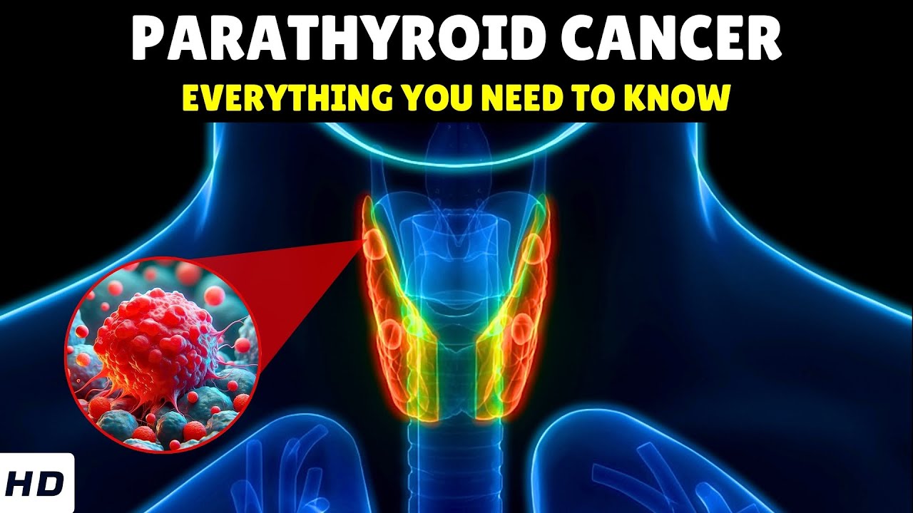 Parathyroid Cancer – Causes, Signs and Symptoms, Diagnosis & Treatment ...