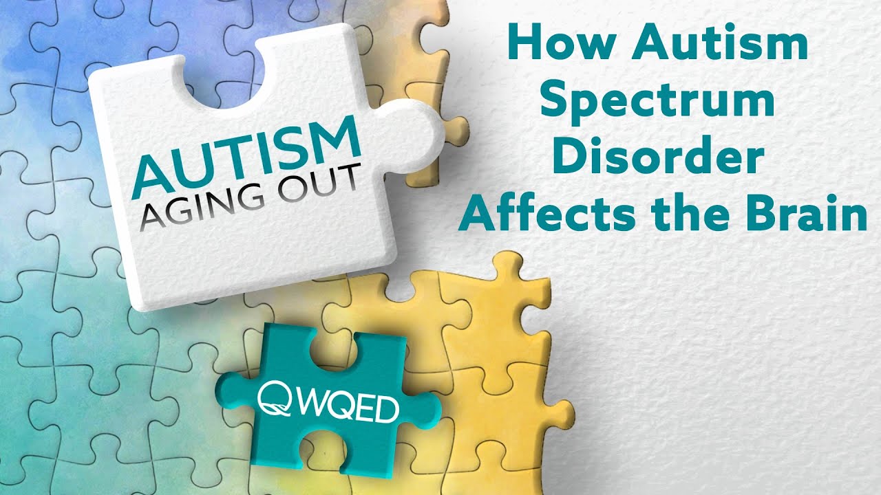 How Autism Spectrum Disorder Affects the Brain | Autism: Aging Out ...