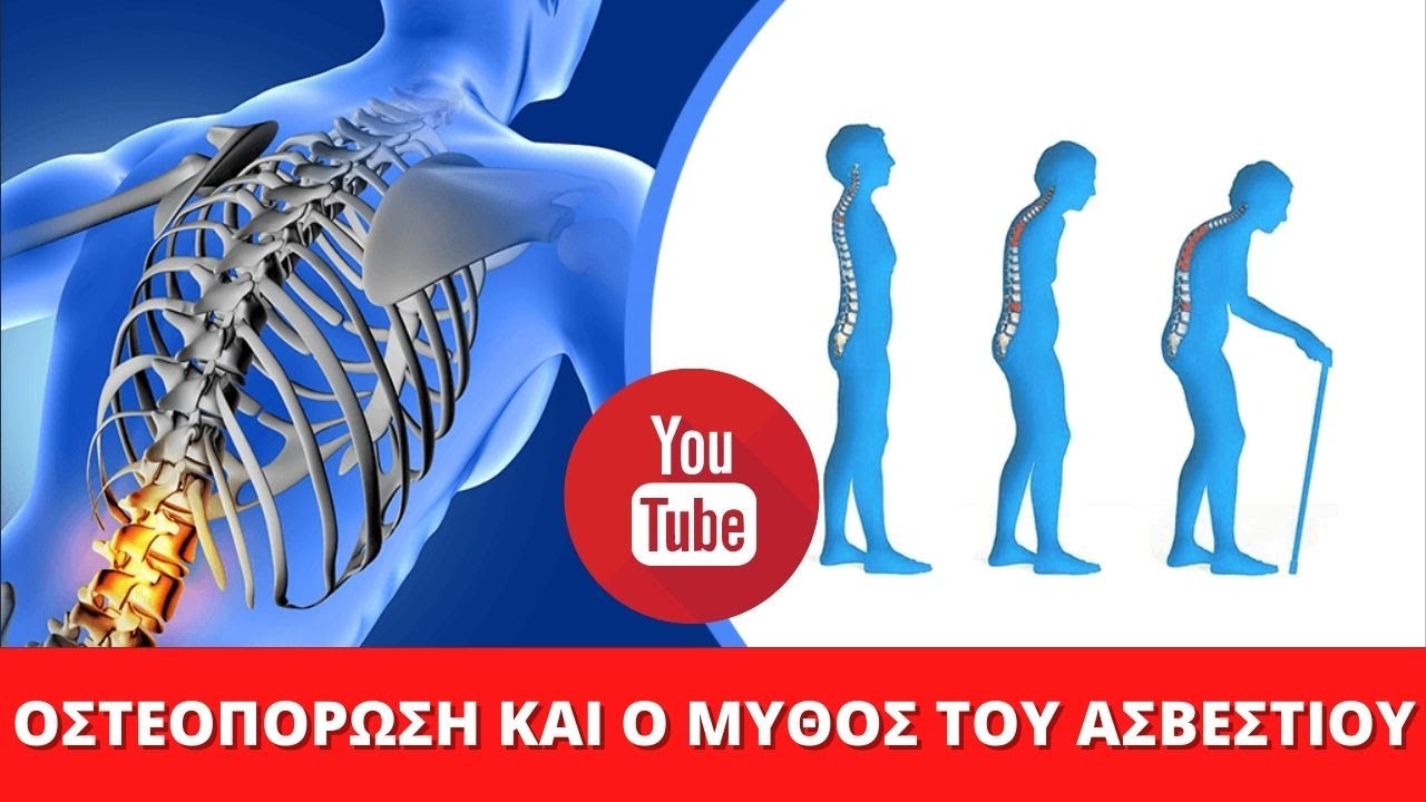 Οστεοπόρωση και ο μύθος του ασβεστίου - YouTube