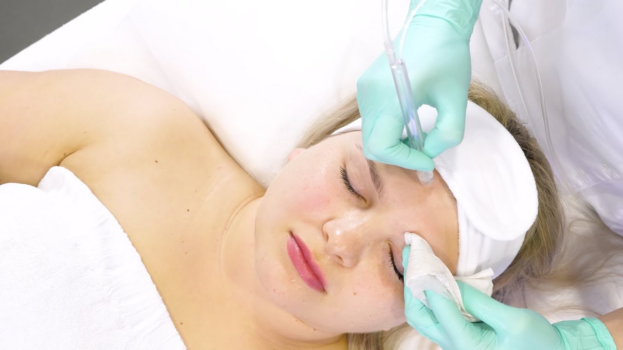 Oxybrazja (oksybrazja) Body Care Clinic Katowice - YouTube