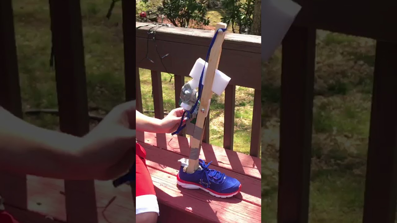 Adam Prosthetic leg project - YouTube
