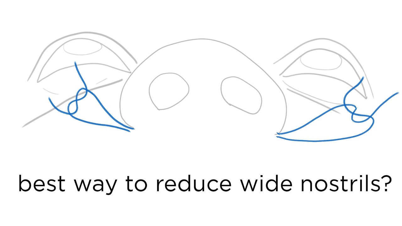 A dependable trick to make nostrils smaller and reduce alar flaring ...
