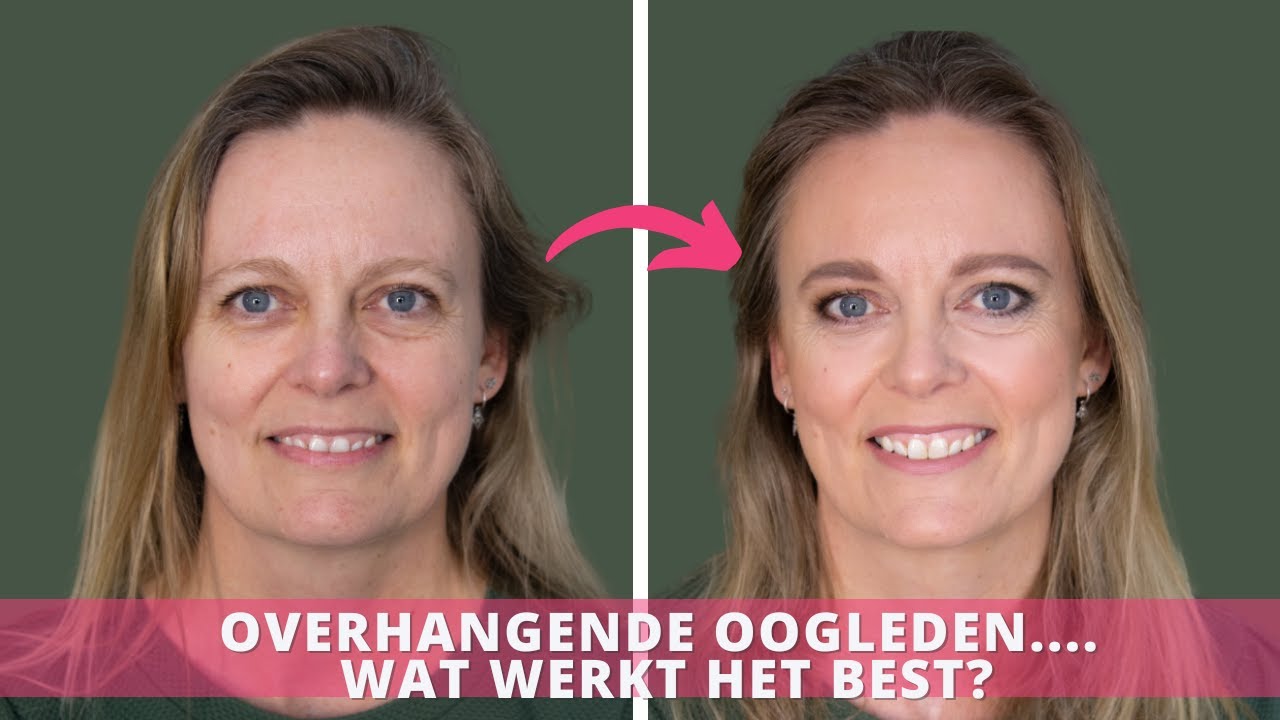 Overhangende Oogleden.... Wat Werkt Het Best? | Mintenz - YouTube