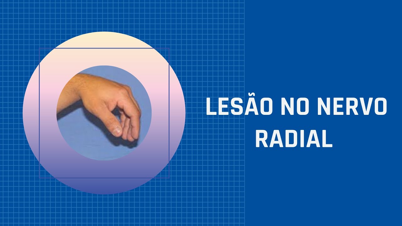 Lesão no nervo radial - YouTube