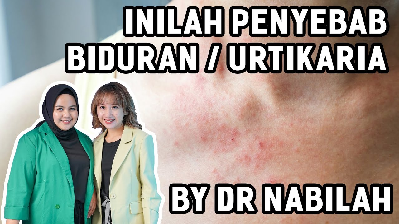 APA PENYEBAB BIDURAN ATAU URTIKARIA? APAKAH DISEBABKAN OLEH ALERGI ...