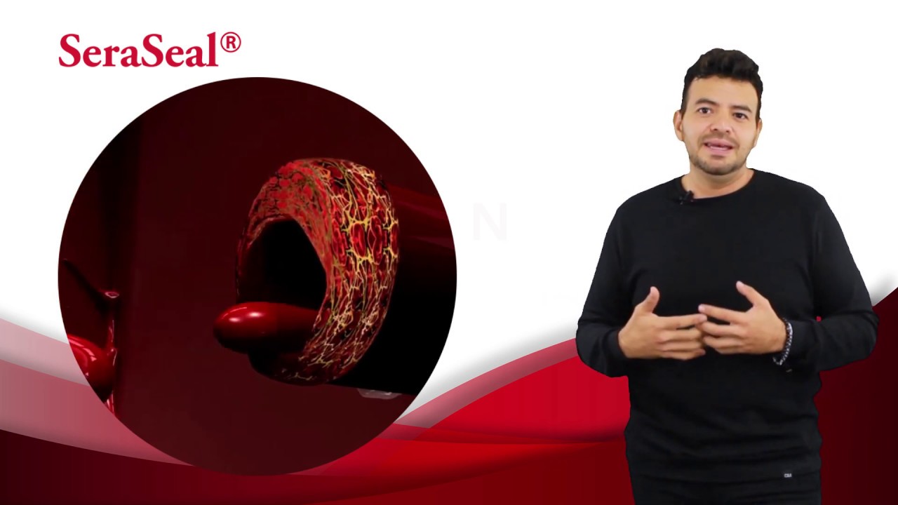 Alcanza la hemostasia en segundos con Seraseal®. - YouTube