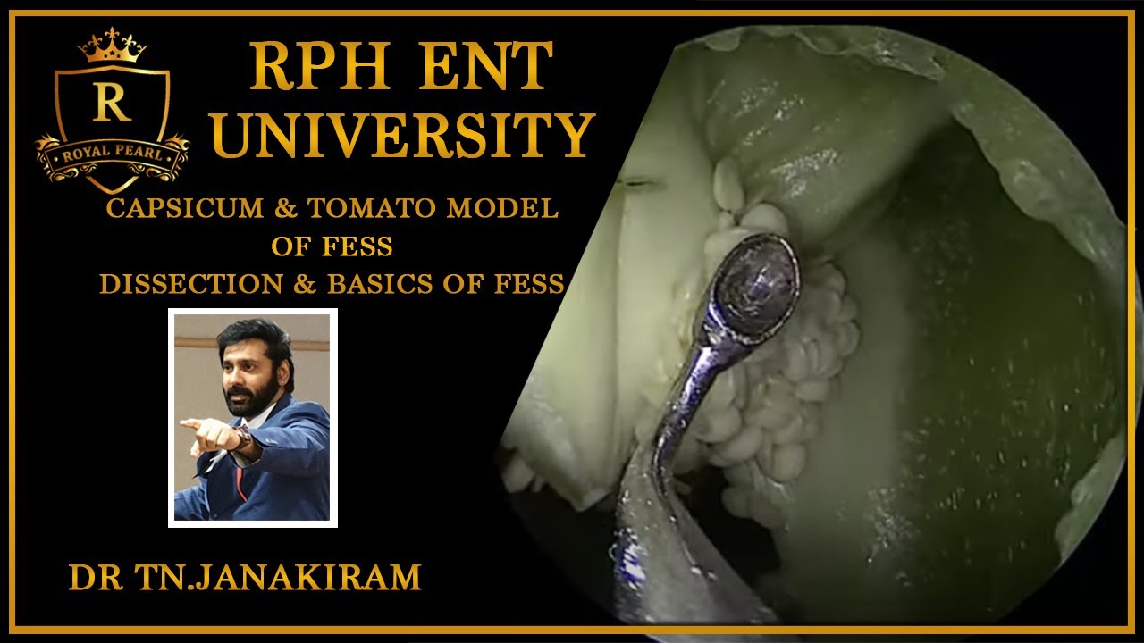 Capsicum & Tomato Model of FESS Dissection & Basics of FESS - YouTube
