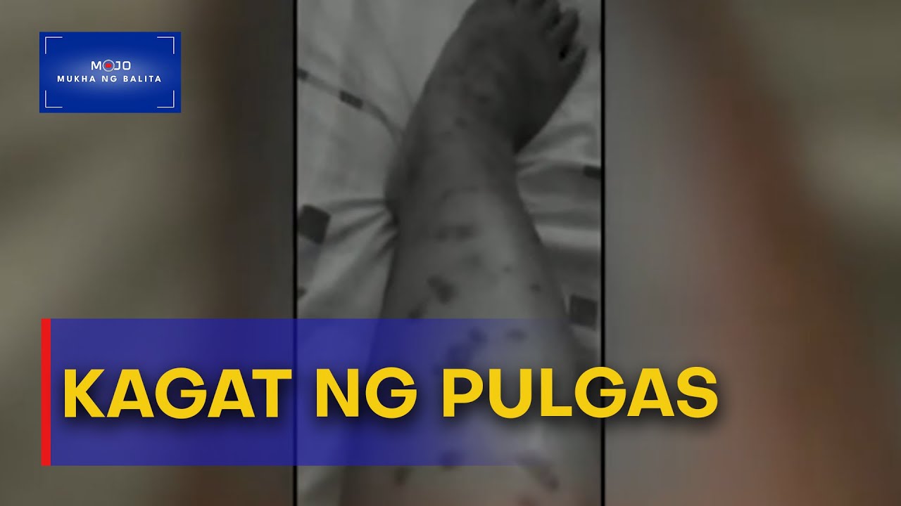Mga pulgas mula sa alagang hayop, posible ring makahawa ng tao | Mukha ...