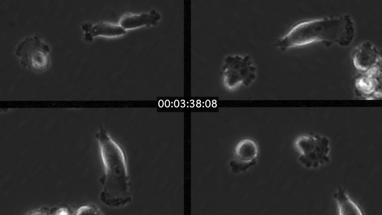 Additional Video N° 9 Cell Membrane ruffling - YouTube