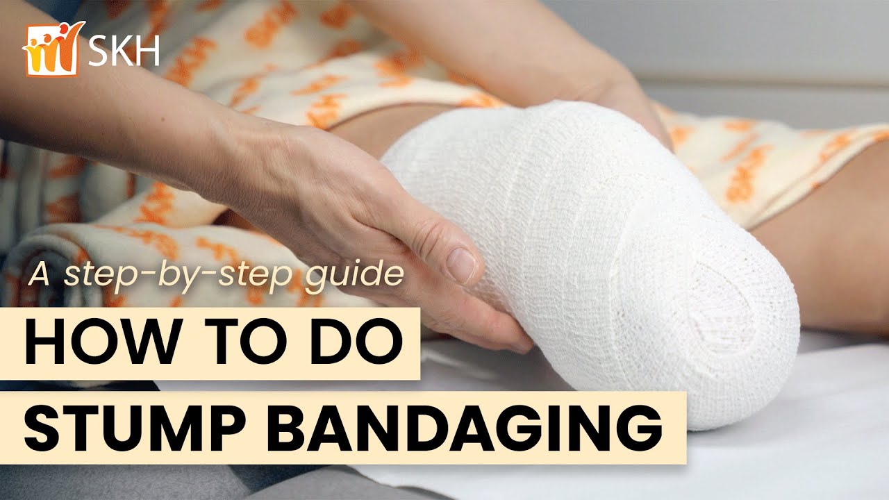 How to Do Figure-of-8 Stump Bandaging for Below-Knee Amputation - YouTube