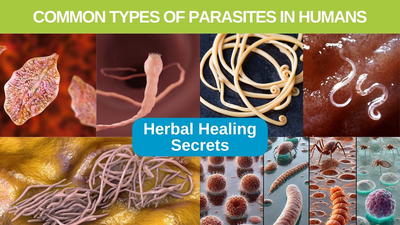 Types of Parasites In Humans - Secrets Of Herbal Healing - Episode 26 ...