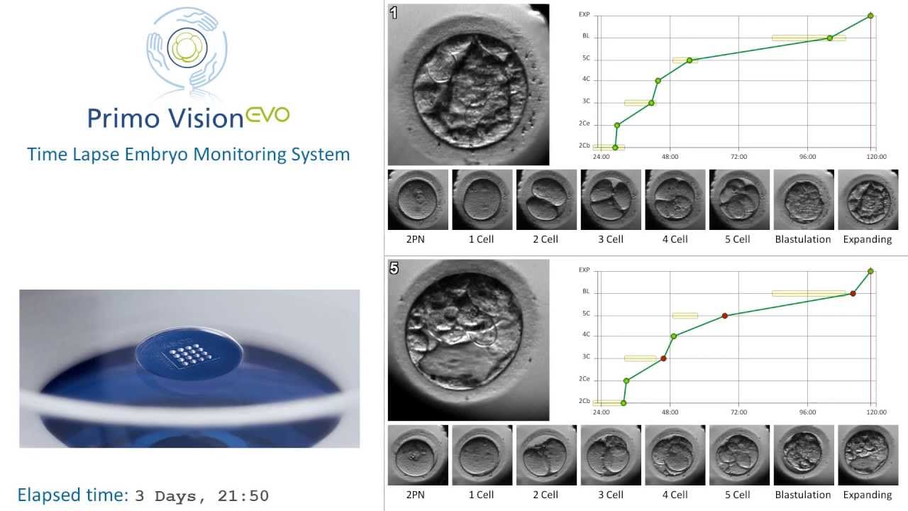 PRIMO vision - YouTube