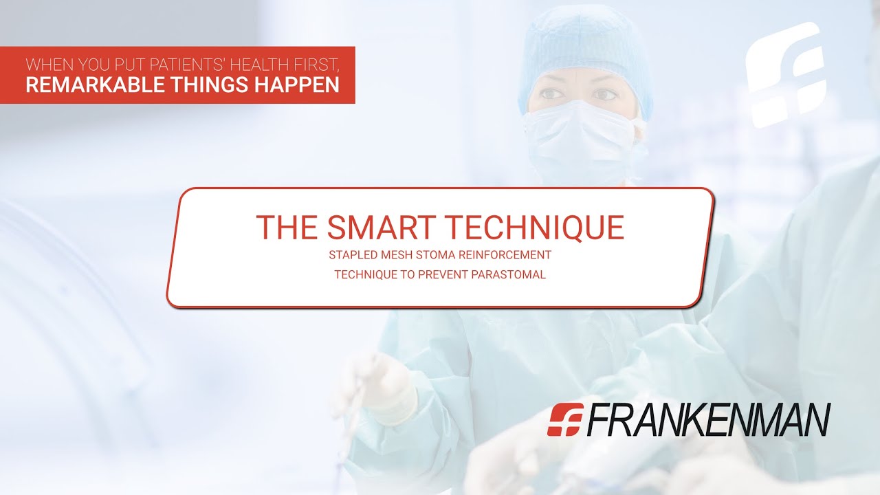 The SMART Technique Stapled Mesh Stoma Reinforcement Technique to ...