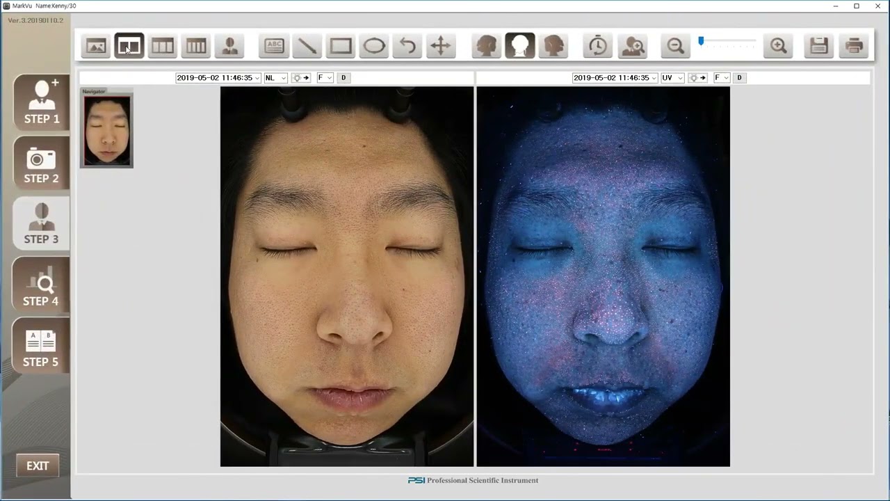 Operating Mark-Vu Facial Skin Analyzer - YouTube