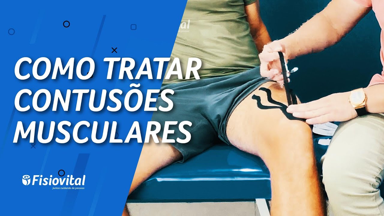 Como Tratar Contusões Musculares e Inchaços com Bandagem Funcional ...