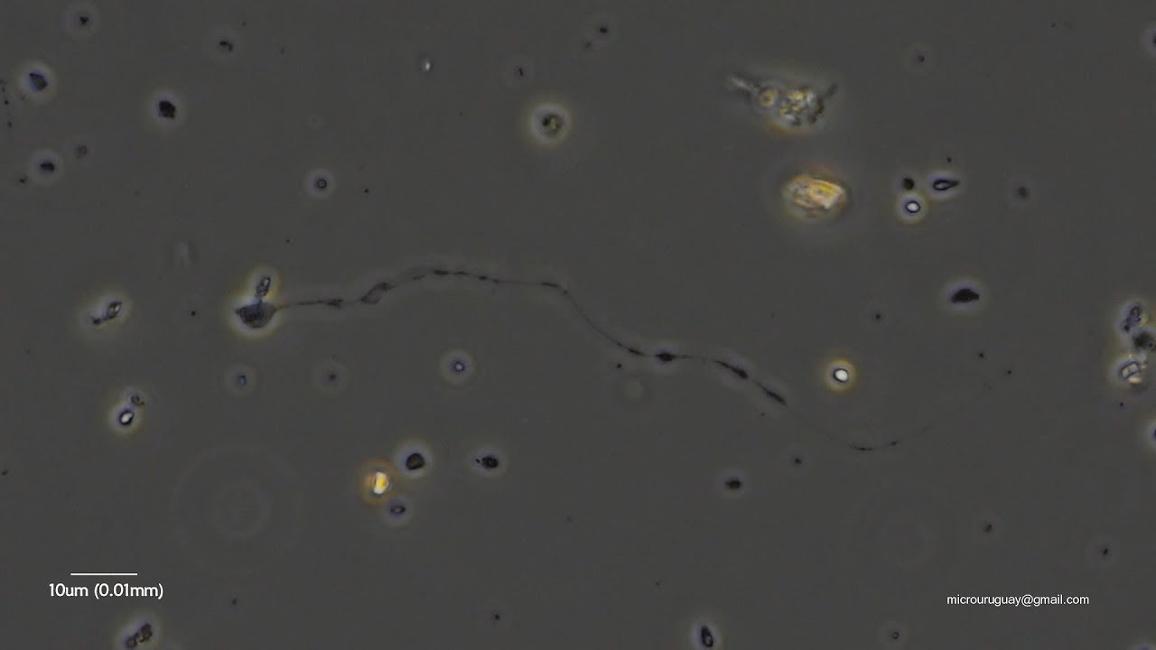 Ameboide - Amoeboid - YouTube