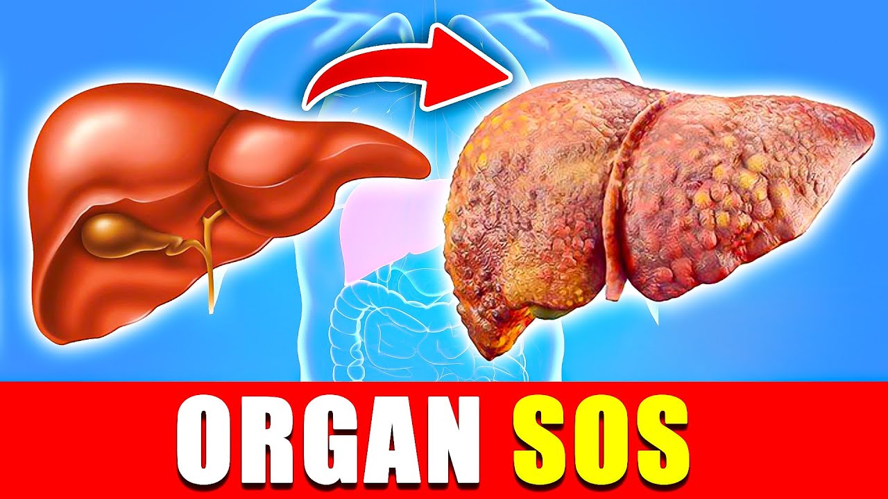 15 Warning Signs Your Liver Is Crying for Help - YouTube