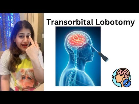 HORRIFYING History of Psychology!! Lobotomy- Scary facts - YouTube