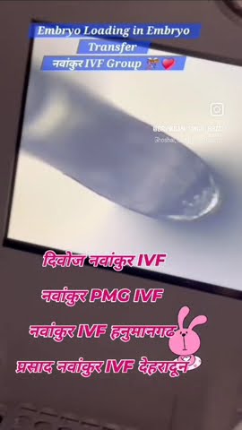 Embryo Loading procedure in Embryo Transfer.. नवांकुर IVF GROUP 🎊 ♥️ ...