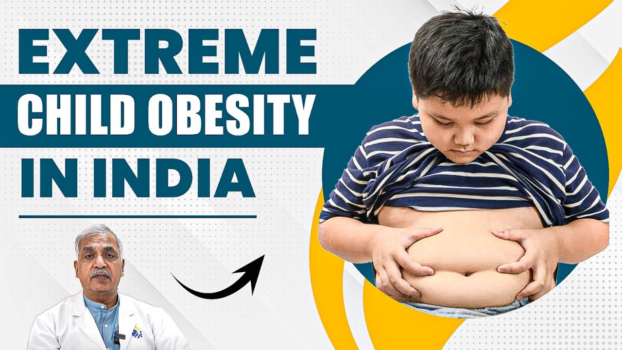Extreme Child Obesity In India | How Overweight Causes Health Issues ...