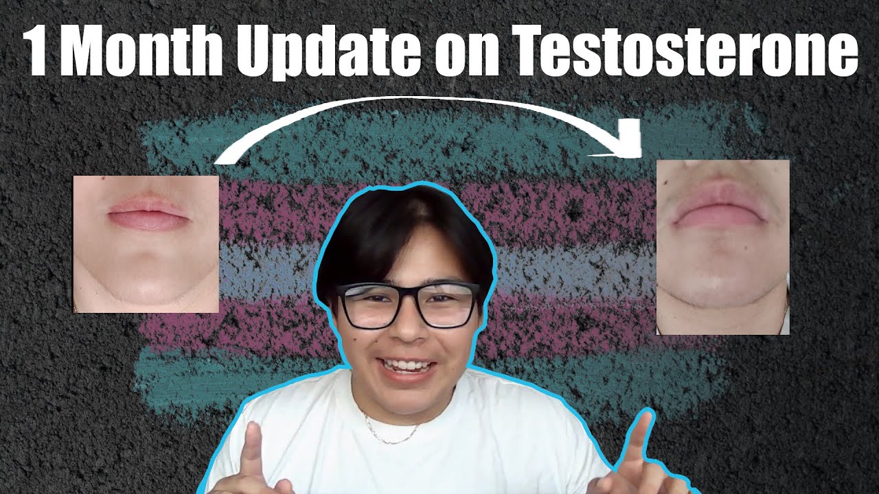 FTM Transition: One Month Update on Testosterone - YouTube