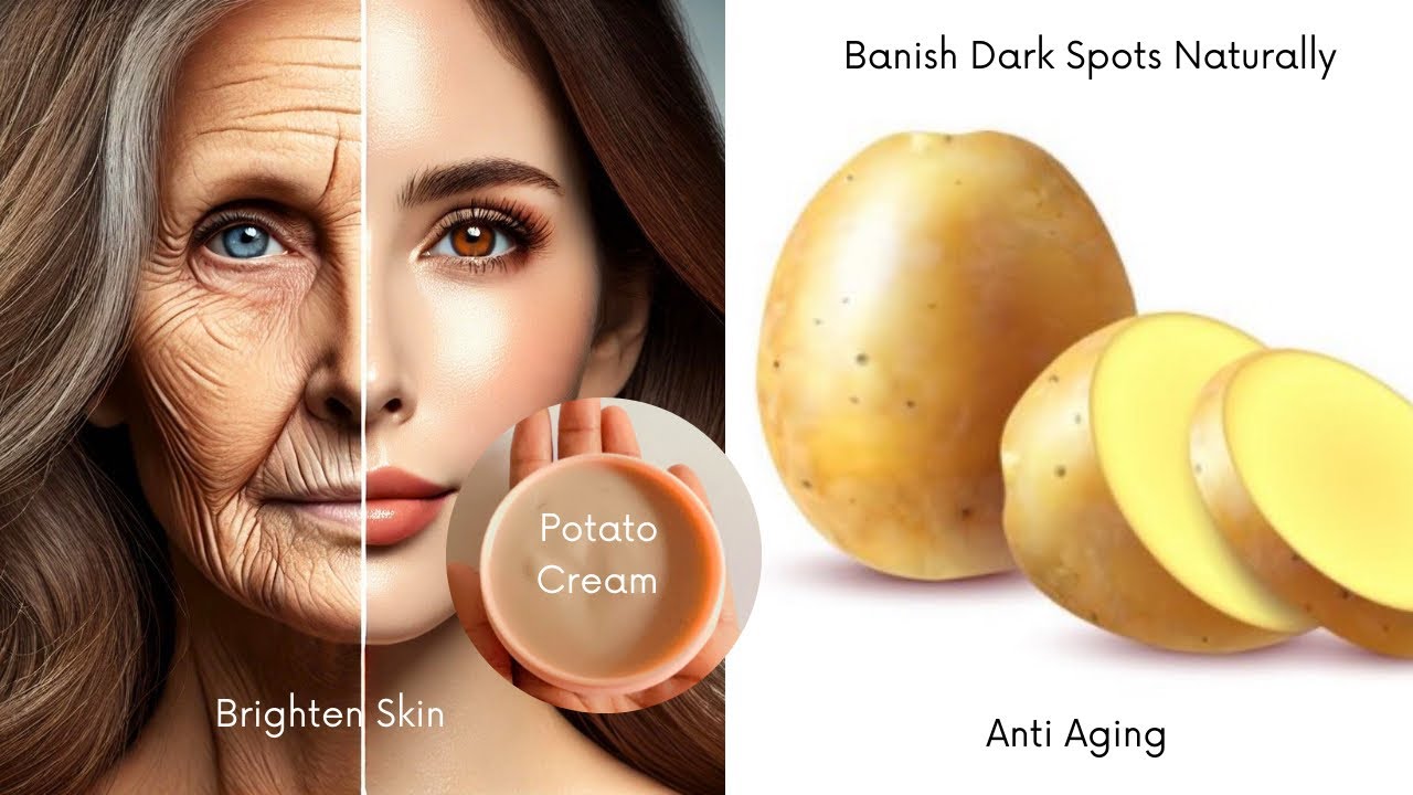 Does Potato Cream Really Work for Hyperpigmentation? - YouTube