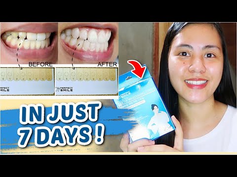 MAPUTING NGIPIN IN JUST 7 DAYS! HIGHLY SUGGESTED ❤️(PERFECT SMILE DIY TEETH WHITENING) | SteffiRay🌻