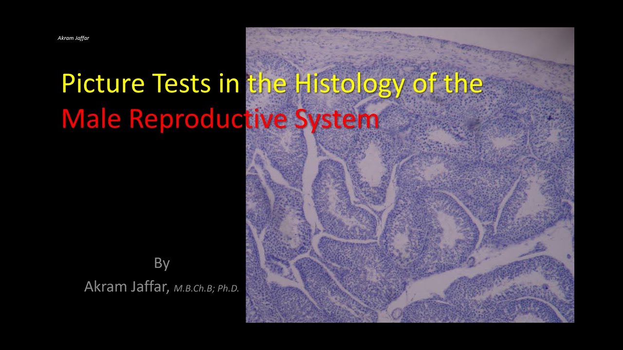 Picture tests in histology reproductive system - male - YouTube