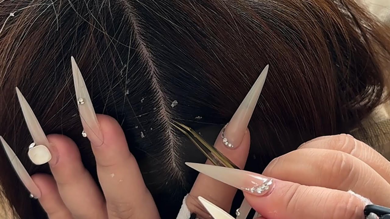 Ultra Zoom Dandruff Removal | Tweezers Plucking, Long Nail Scratching ...