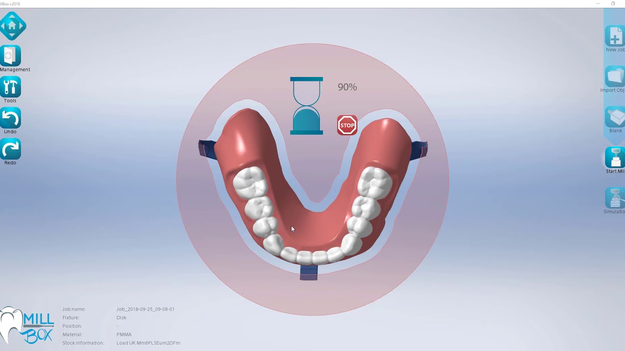 MillBox - How to manage the Baltic Denture Machining - YouTube
