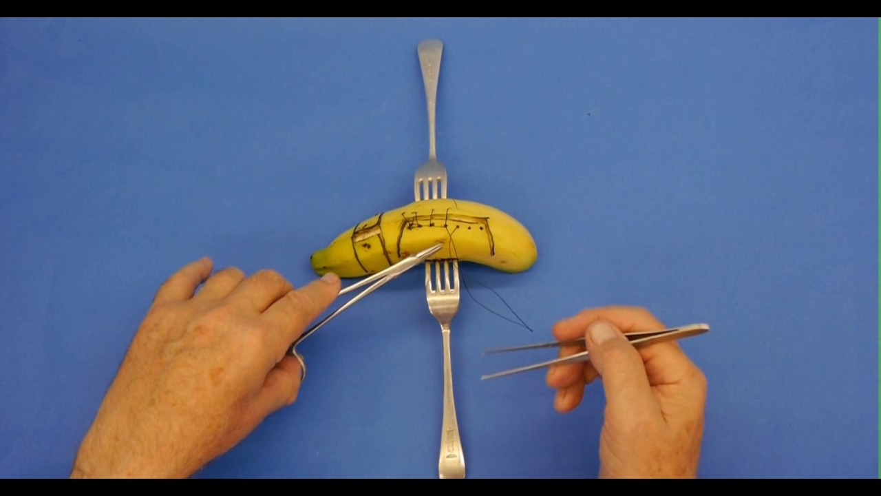 12 Sinus Continuous Locking - Continuous Locking Suture Left Handed ...
