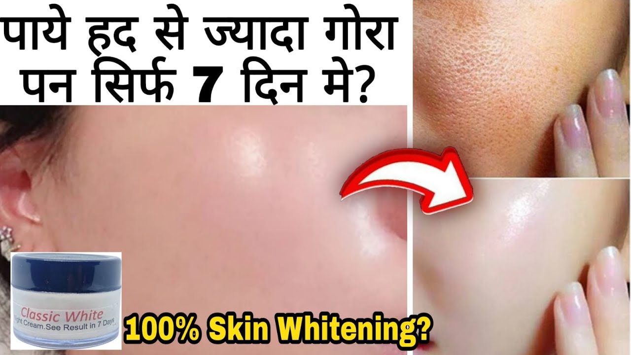 Classic White Cream For Skin Whitening in Just 7 Days?| Is it working ...