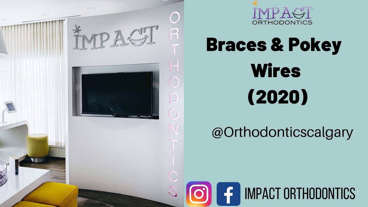 Braces Problems | Pokey Wire - YouTube