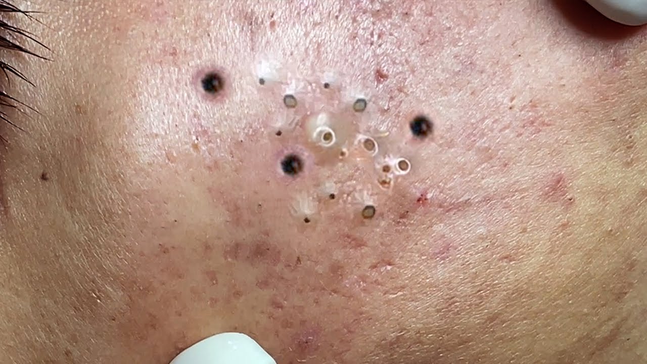 𝐄𝐧𝐣𝐨𝐲 𝐄𝐯𝐞𝐫𝐲 𝐃𝐚𝐲 𝐖𝐢𝐭𝐡 𝐓𝐡𝐞 𝐁𝐞𝐬𝐭 𝐕𝐢𝐝𝐞𝐨 𝐋𝐨𝐚𝐧 𝐍𝐠𝐮𝐲𝐞𝐧 #𝟎𝟔 - YouTube