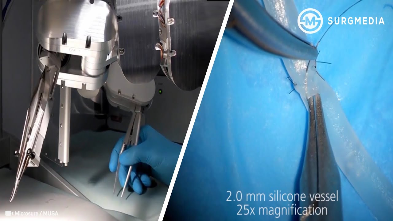 World’s First Clinically Available Microsurgical Robotic System: Super ...