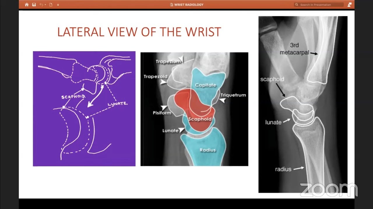 Wrist Imaging Made Easy - YouTube
