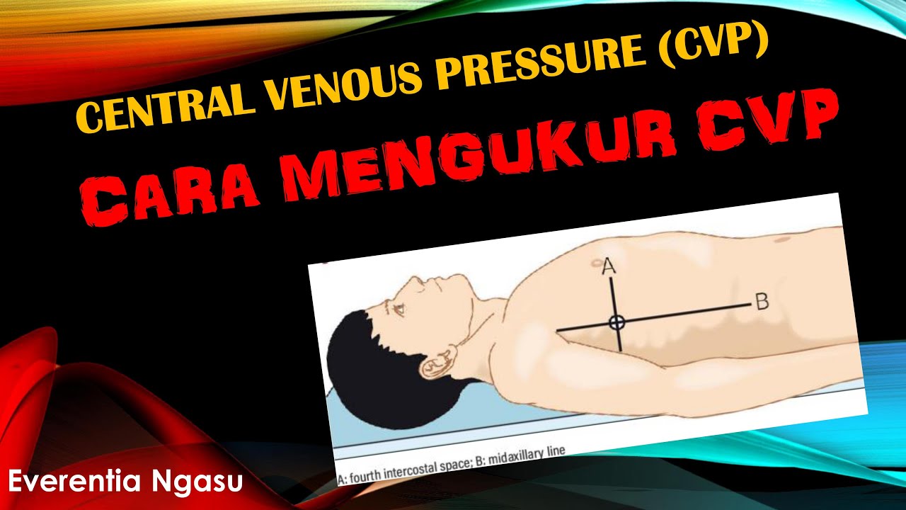 Cara Mengukur CVP - YouTube