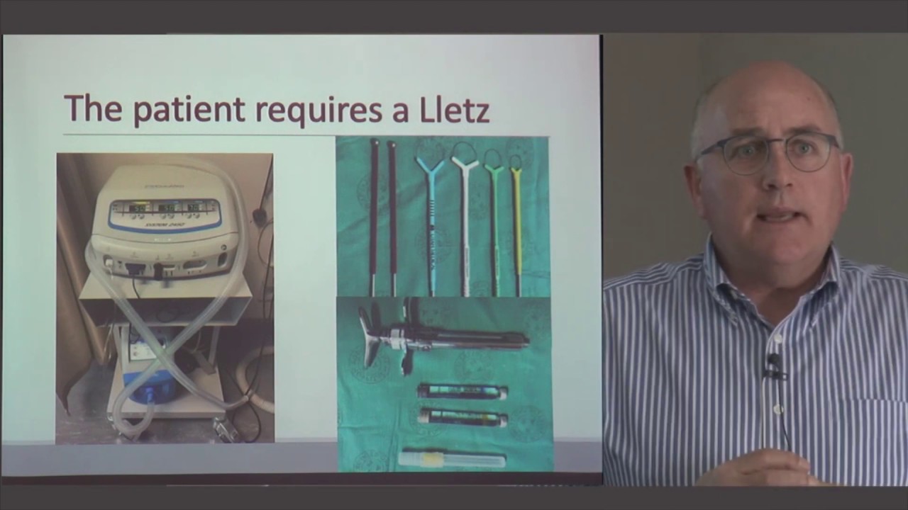 How to setup a colposcopy service - YouTube