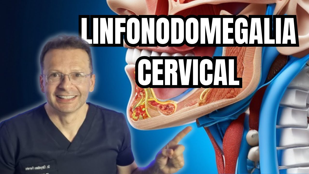 Linfonodomegalia Cervical: Causas, Diagnóstico e Tratamento - YouTube